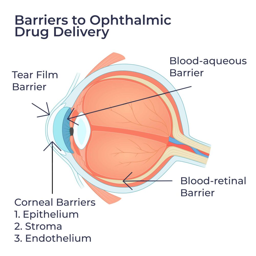 Ophthalmic Drug Development – Callan Pharma Services